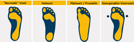 Doorgezakte voet steunzolen | Podobrace.nl